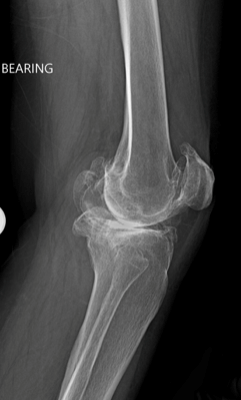 Trudy Murphy | HCA Midwest Health